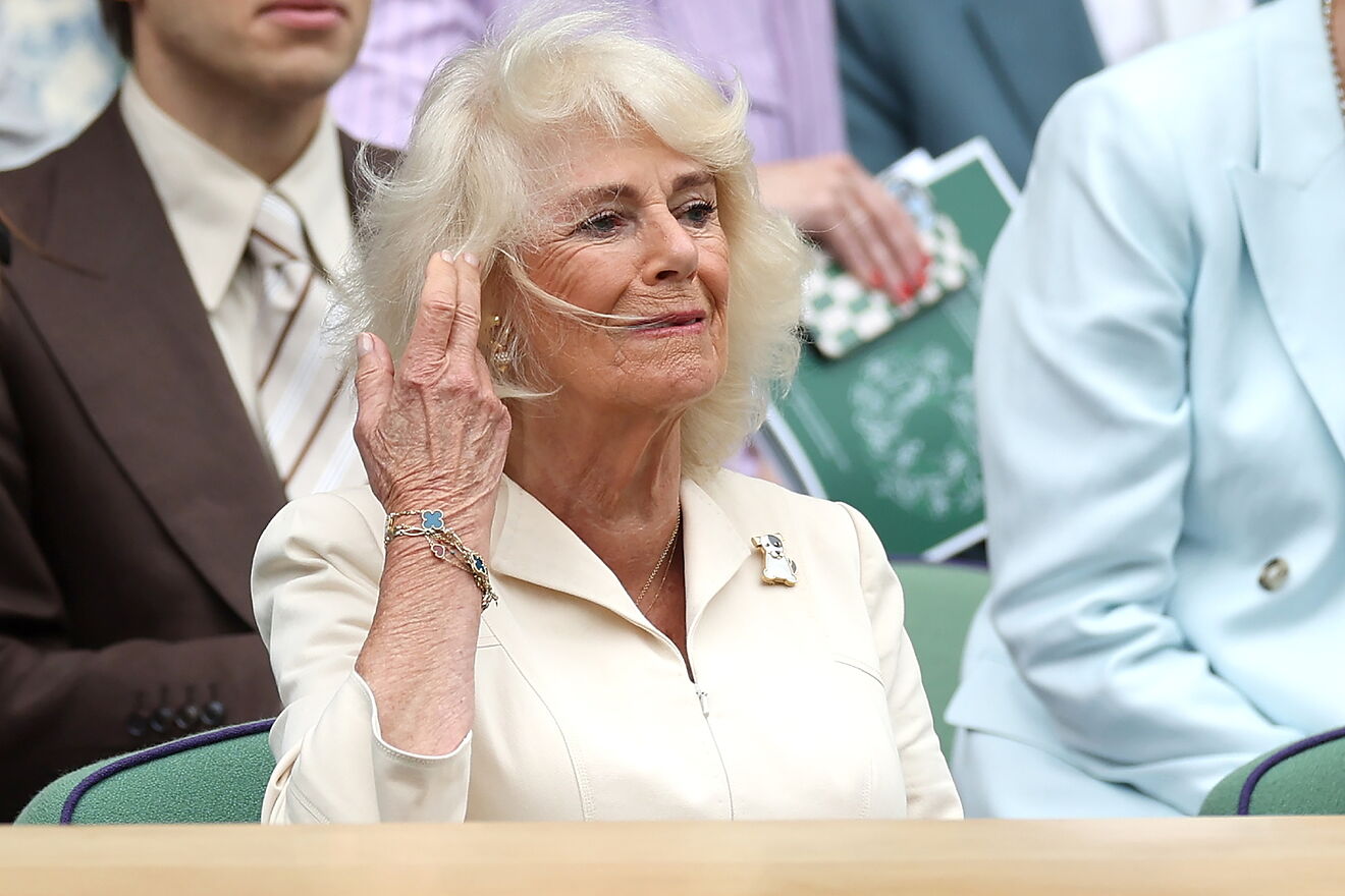 Queen Camilla tries to hide her leg with a bandage after painful injury ...