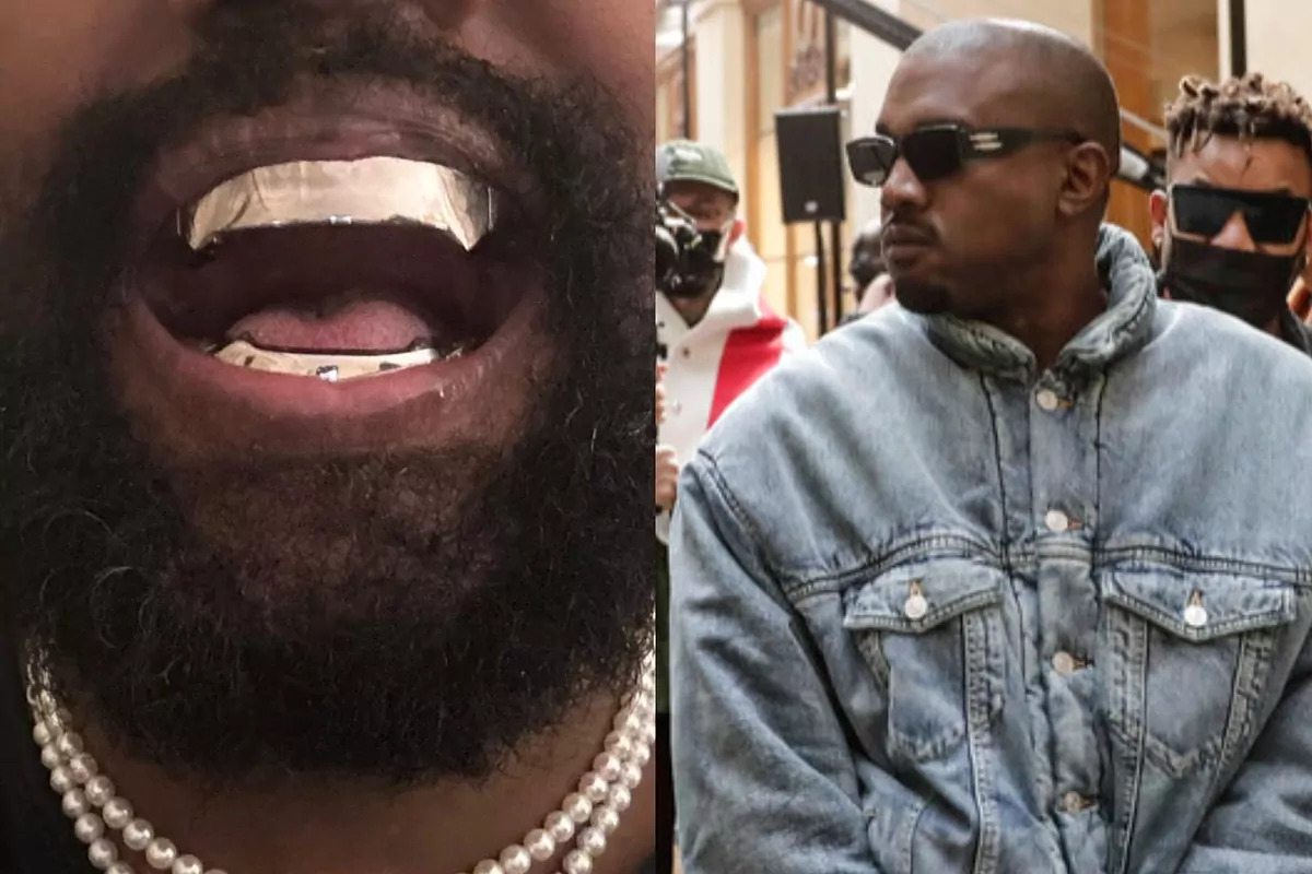 Kanye West spends almost 1 million dollars on titanium grill, did he ...