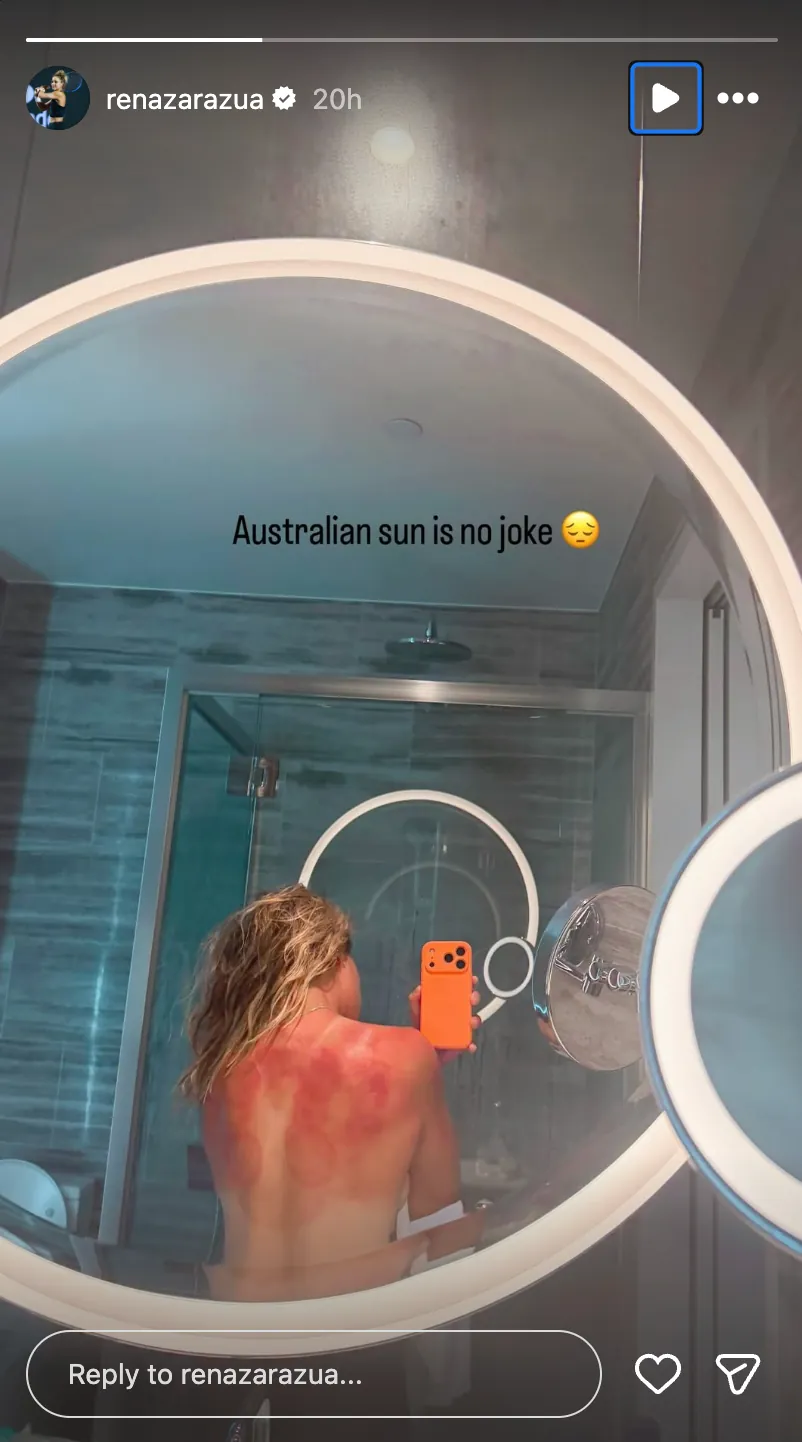 Tennis player Renata Zarazua shows harsh effects of Australian sun ...