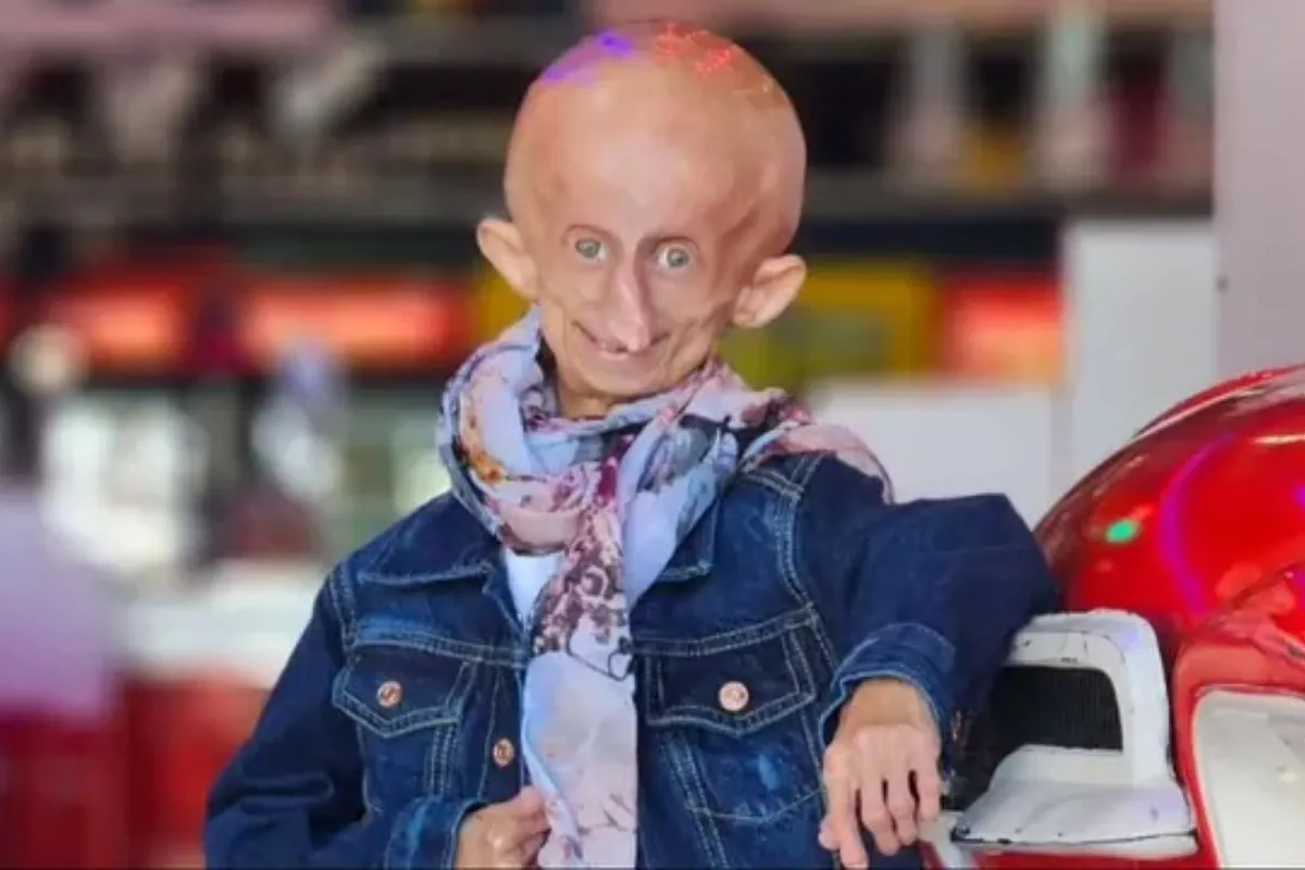 Beandri Booysen cause of death: The influencer who suffered from a ...