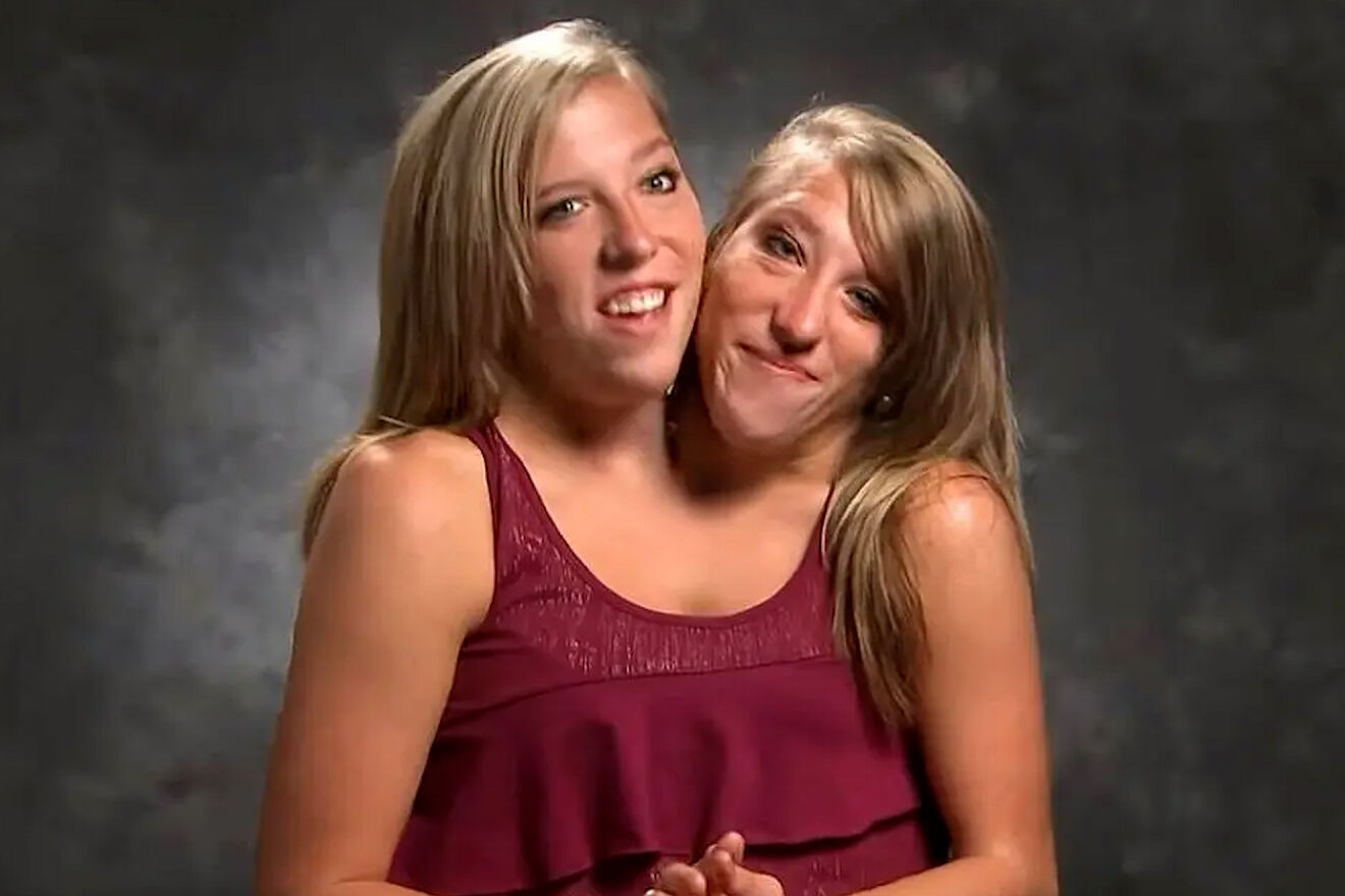 Conjoined twin Abby Hensel from "Abby & Brittany" ties the knot and is ...