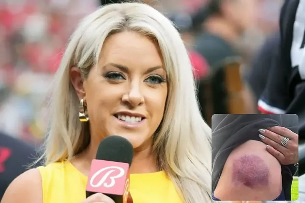 MLB FOX reporter shows off horrible bruise on her stomach after being ...