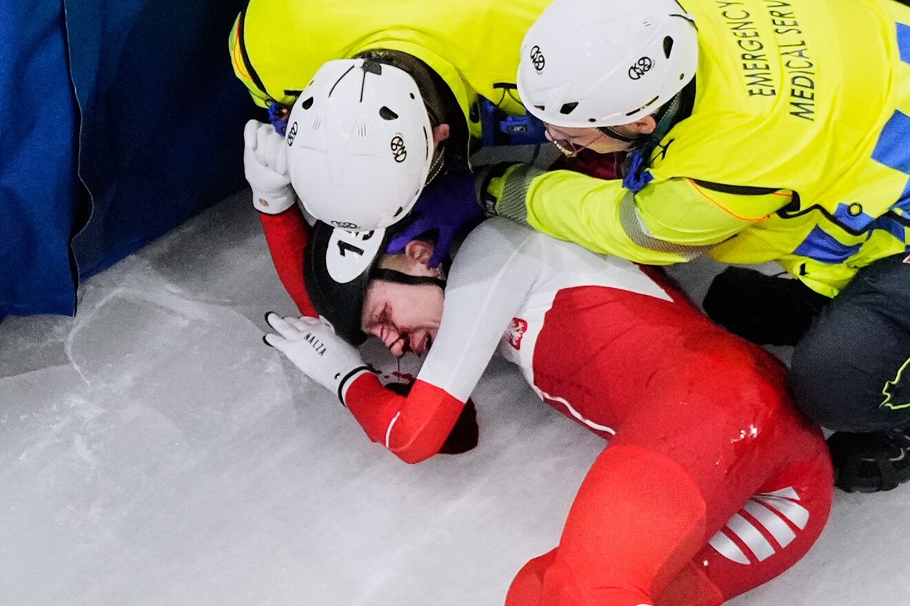 Winter Olympics horror: Kamila Sellier suffers facial injury in ...