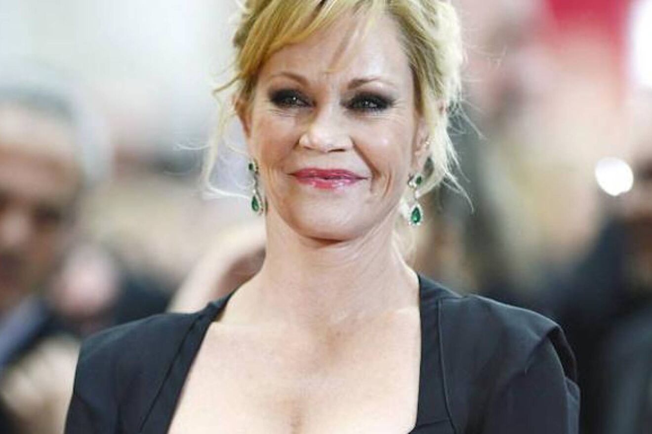 Melanie Griffith's shocking image with a new scar after her battle with ...