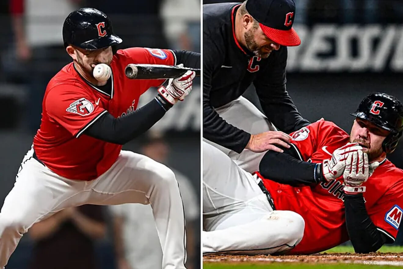 David Fry injury update: Guardians DH exits after being hit in face by ...