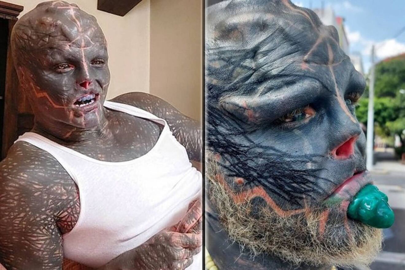 Anthony Loffredo, the 'Black Alien' now wants to amputate his leg after ...